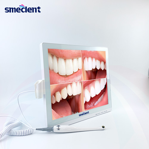 Intra-oral Camera with 17” LED Screen - Smedent Medical